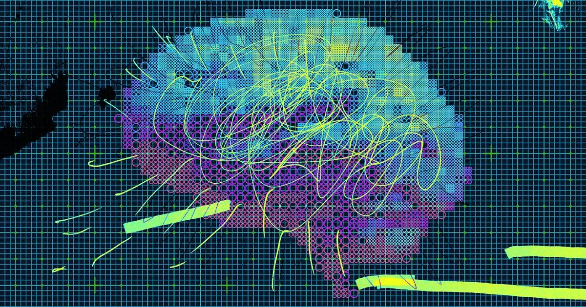 Brain Implant Companies Apparently Have an Extremely Dirty Secret ...